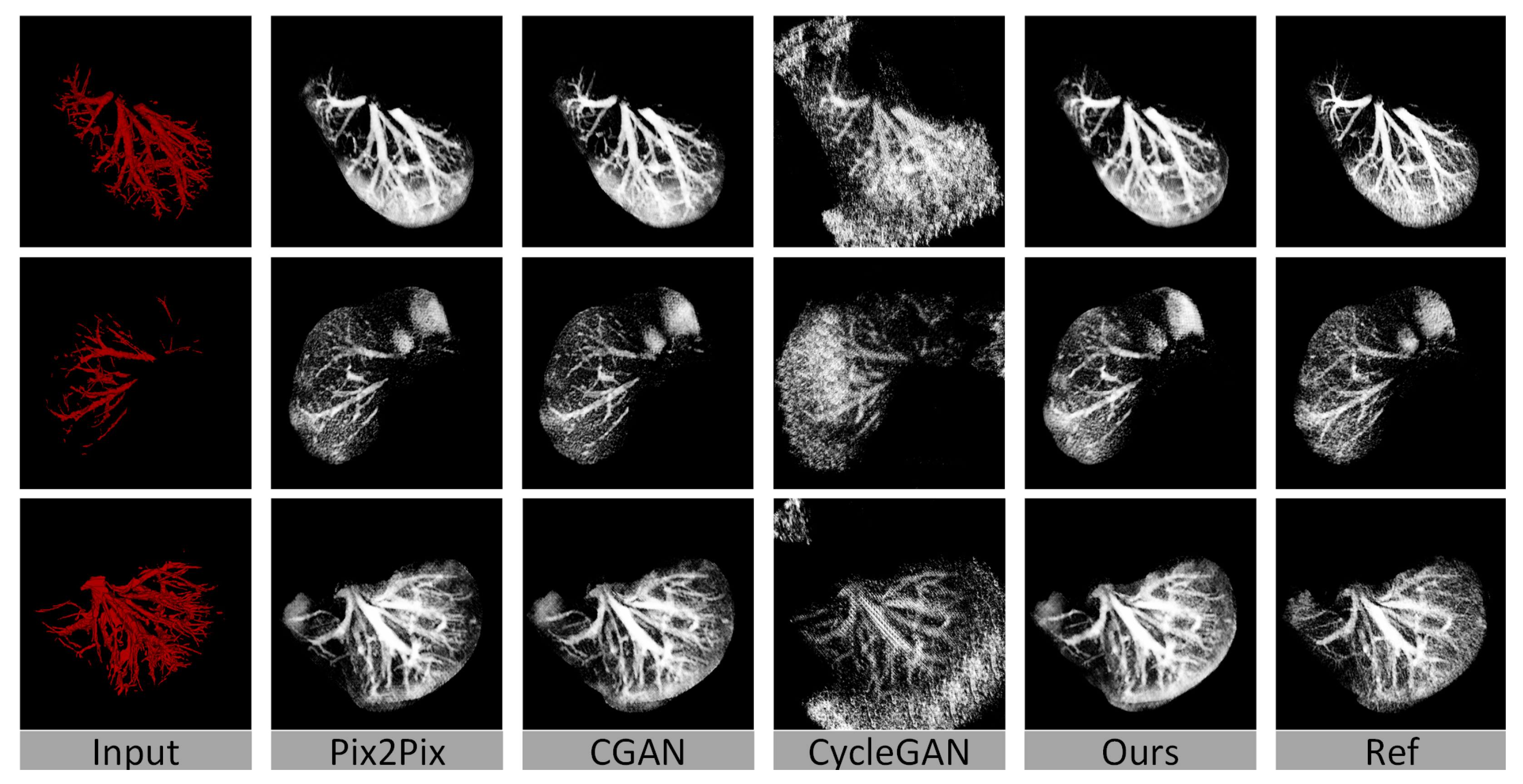 End-to-End 3D Liver CT Image Synthesis from Vasculature Using a Multi-Task Conditional ...