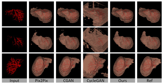 End-to-End 3D Liver CT Image Synthesis from Vasculature Using a Multi-Task Conditional ...
