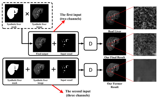 End-to-End 3D Liver CT Image Synthesis from Vasculature Using a Multi ...