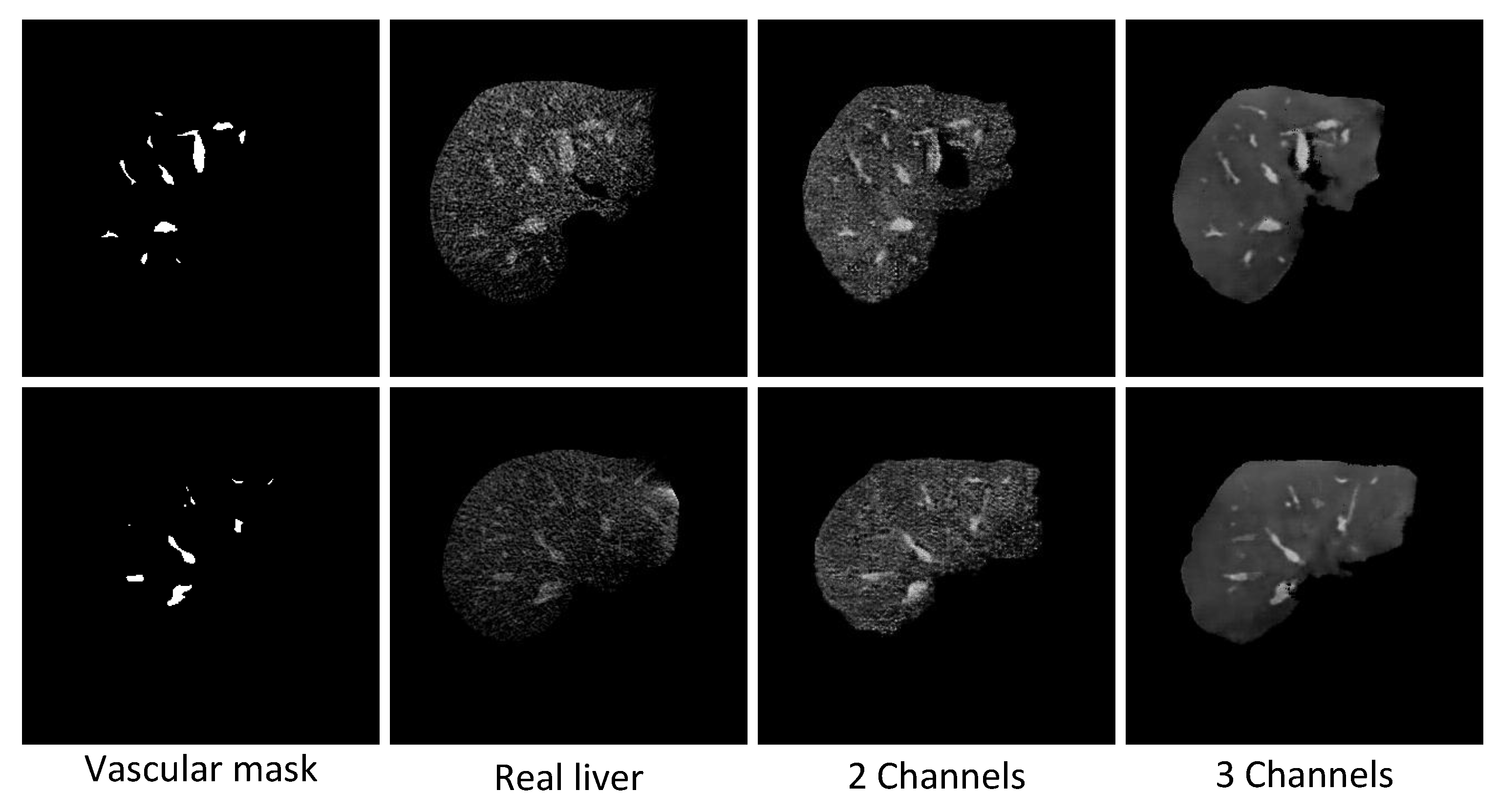 End-to-End 3D Liver CT Image Synthesis from Vasculature Using a Multi ...