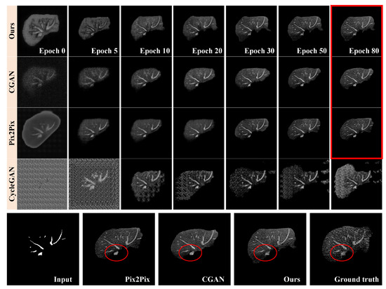 End-to-End 3D Liver CT Image Synthesis from Vasculature Using a Multi-Task Conditional ...