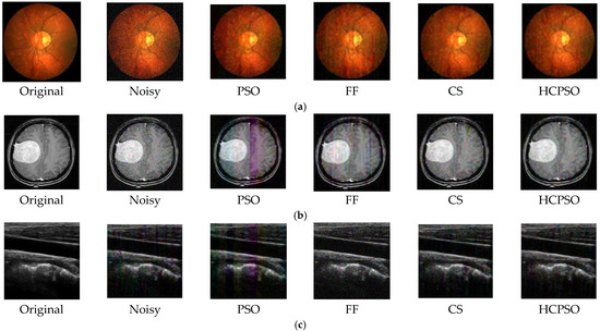 A Novel Guided Box Filter Based on Hybrid Optimization for Medical ...