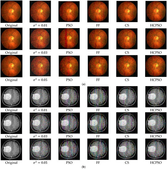 A Novel Guided Box Filter Based on Hybrid Optimization for Medical ...