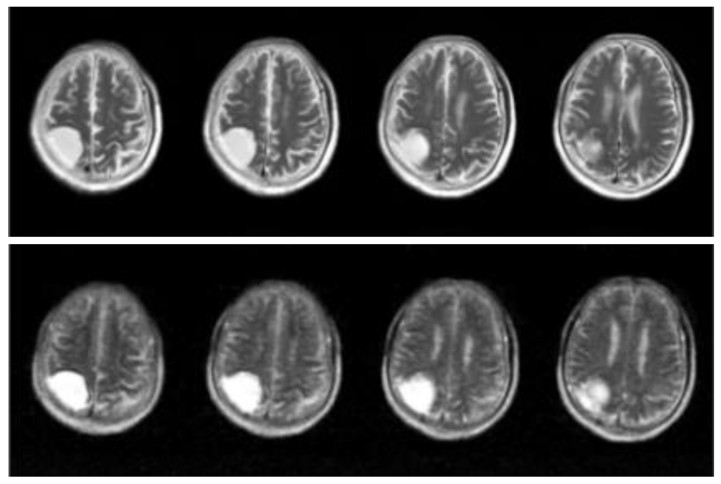 Advances in Computer-Aided Medical Image Processing