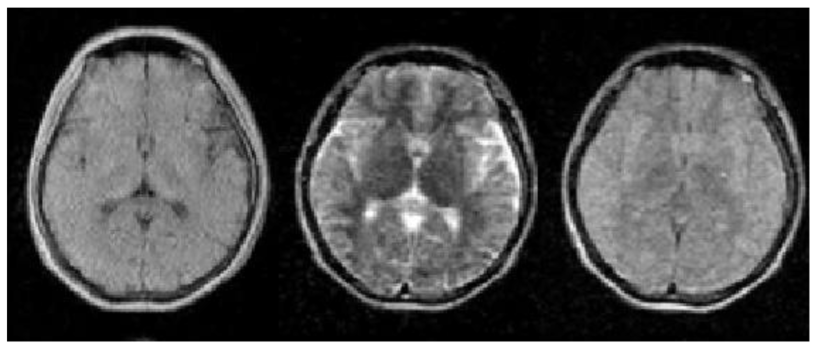 Advances in Computer-Aided Medical Image Processing