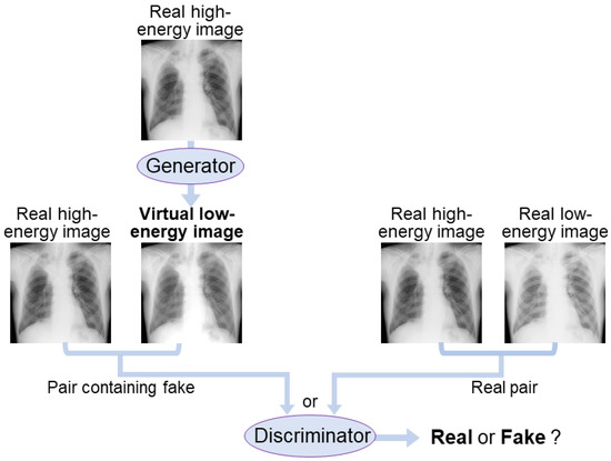 Development of Artificial Intelligence-Based Dual-Energy Subtraction for Chest Radiography