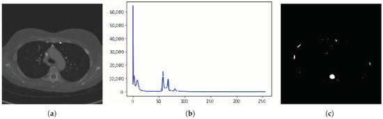 Optimal Thresholding for Multi-Window Computed Tomography (CT) to ...