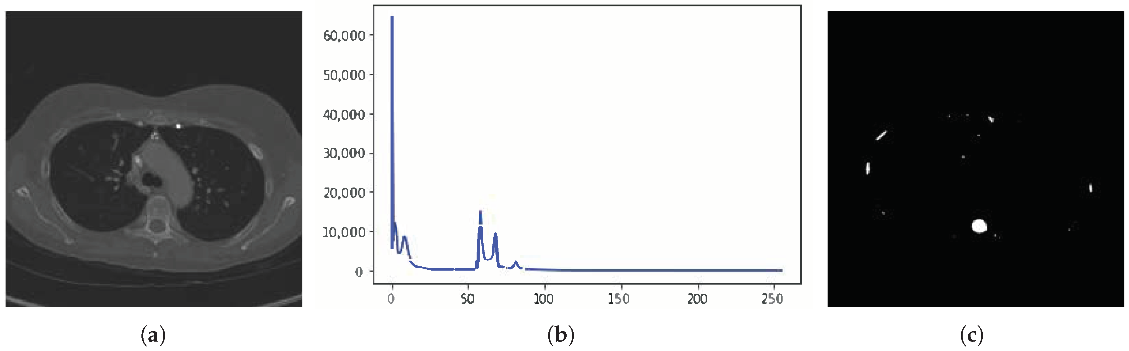 Optimal Thresholding for Multi-Window Computed Tomography (CT) to ...