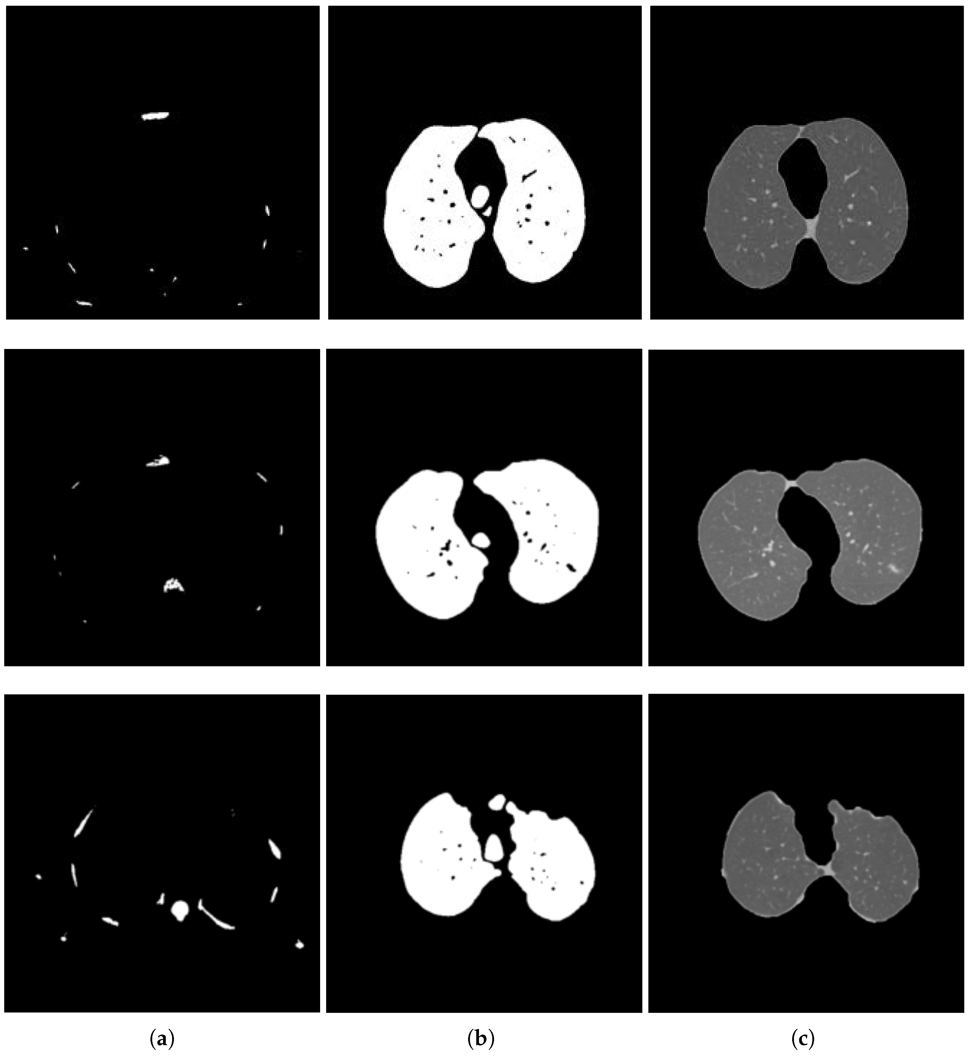 Optimal Thresholding for Multi-Window Computed Tomography (CT) to ...