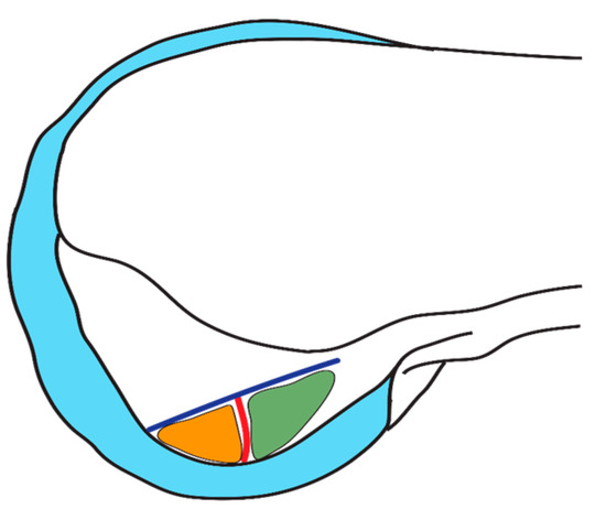 Feasibility of Osseous Landmarks for ACL Reconstruction—A Macroscopic ...