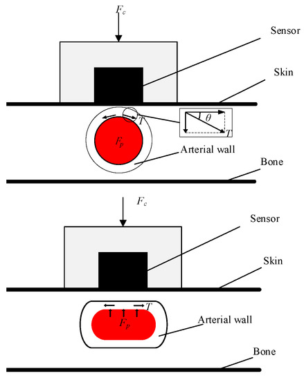 Blood Pressure Monitoring Based on Flexible Encapsulated Sensors