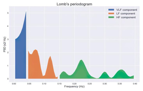Applied Sciences | Free Full-Text | Estimation of Heart Rate and Heart ...