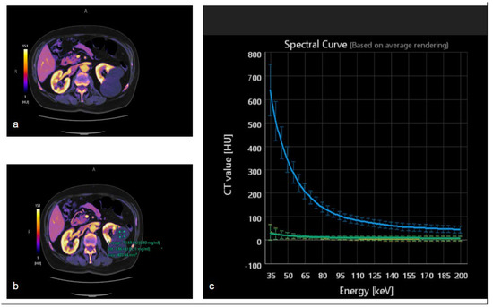 Applied Sciences | Free Full-Text | Dual-Energy CT Applications in Urological Diseases