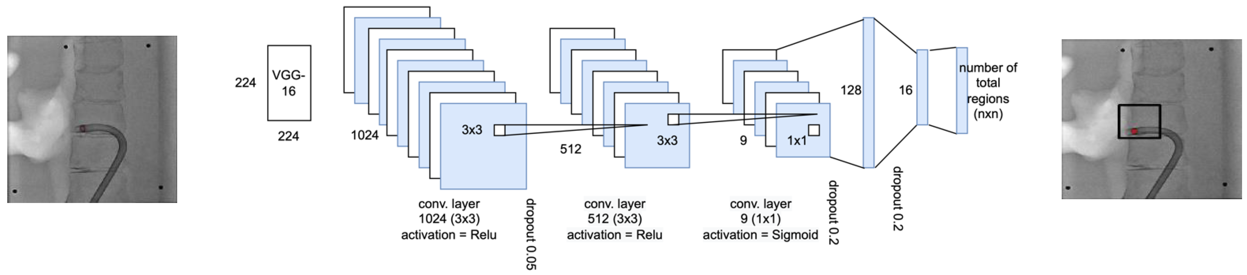 A Coordinate-Regression-Based Deep Learning Model for Catheter Detection during Structural Heart ...