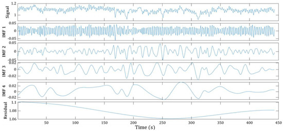 The Use of Empirical Mode Decomposition on Heart Rate Variability ...
