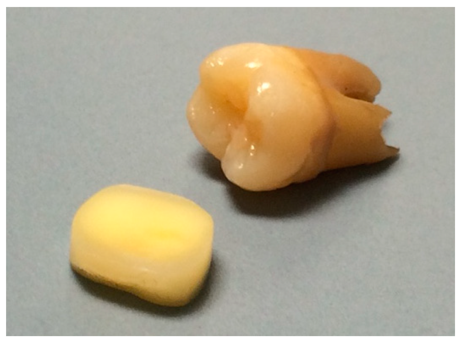 Impact of Preceded Tumor Therapeutic Irradiation on the Microtensile ...