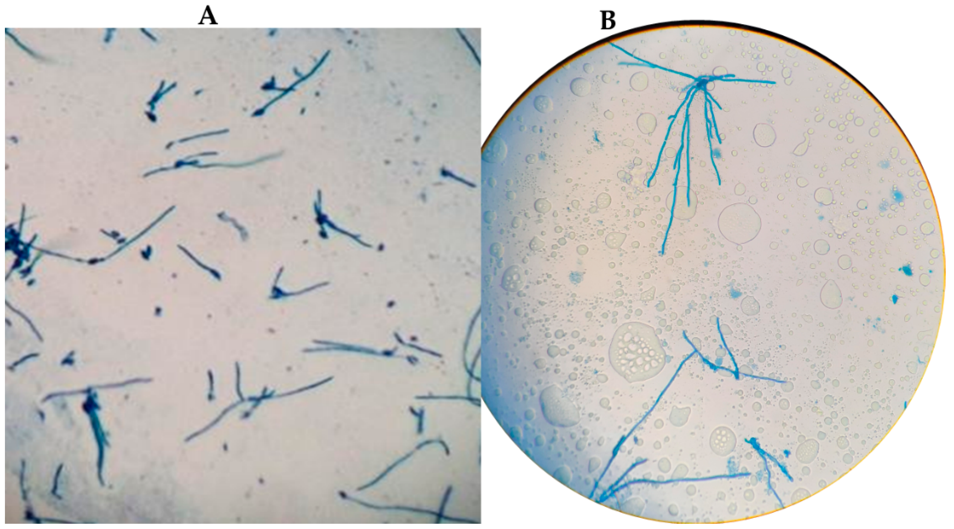 Increased Hirsutella citriformis Conidia Shelf Life in Acacia and ...