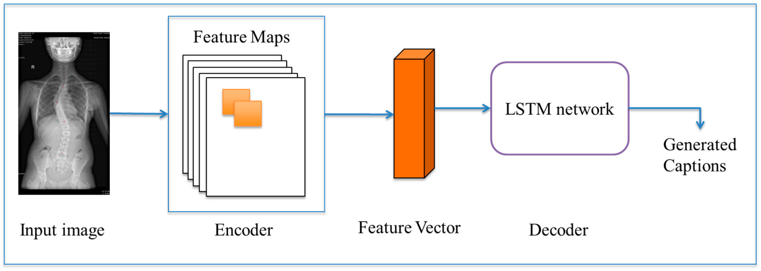 Lenke Classification Report Generation Method for Scoliosis Based on Spatial and Context Dual ...
