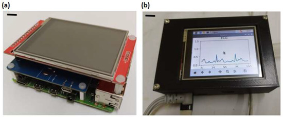 An Embedded System Based on Raspberry Pi for Effective Electrocardiogram Monitoring