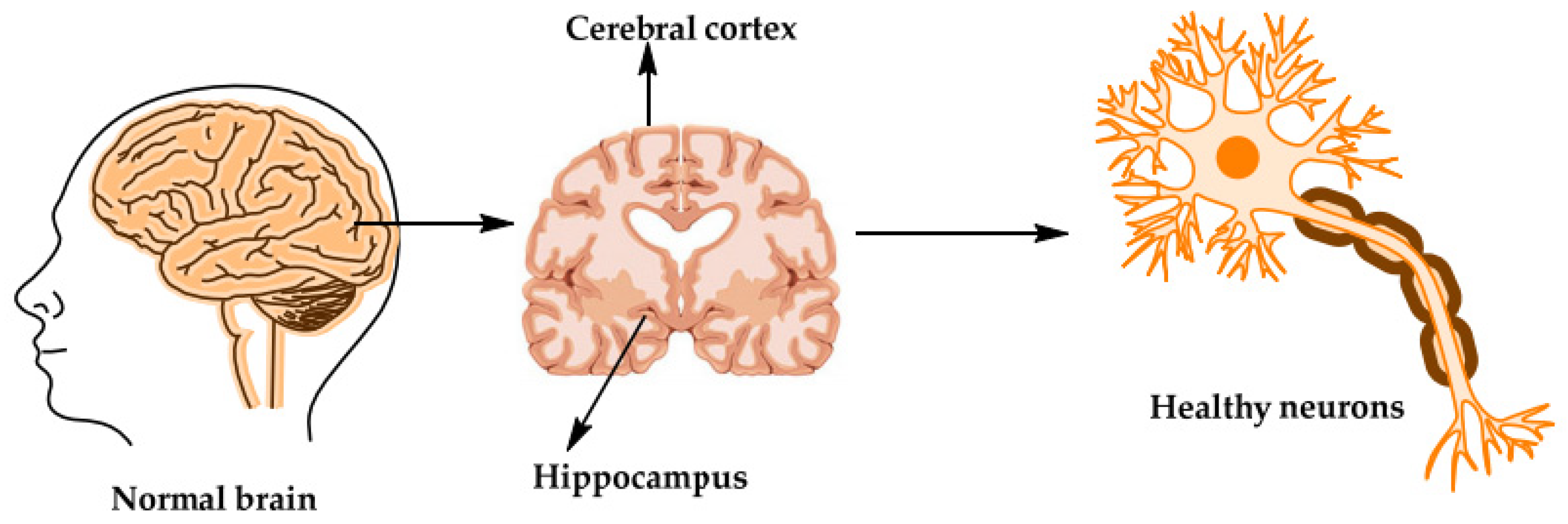 Alzheimer’s Disease Diagnosis Using Machine Learning: A Survey