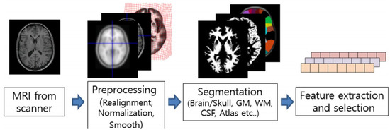 Alzheimer’s Disease Diagnosis Using Machine Learning: A Survey