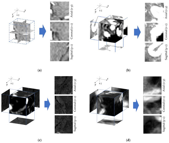 Unsupervised Feature Extraction for Various Computer-Aided Diagnosis Using Multiple ...
