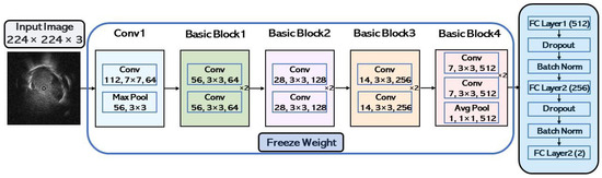Peripheral Pulmonary Lesions Classification Using Endobronchial ...
