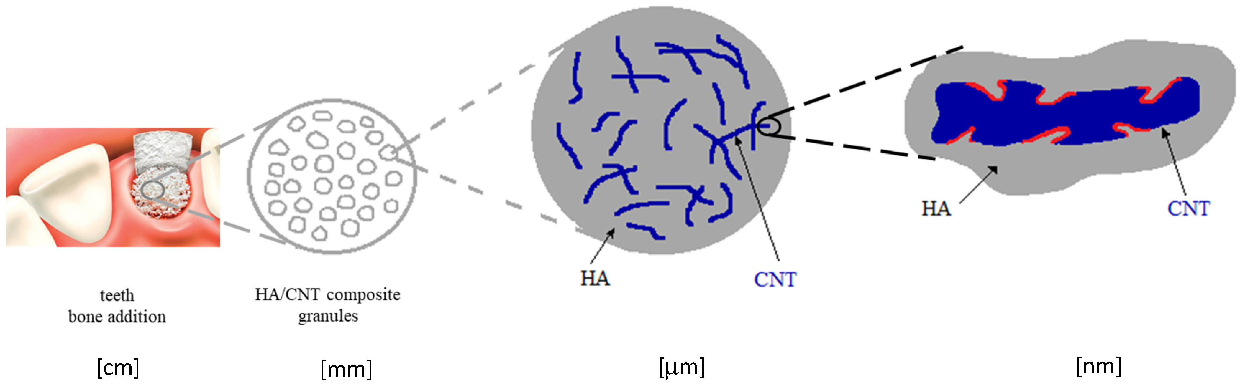 Current Options and Future Perspectives on Bone Graft and Biomaterials ...