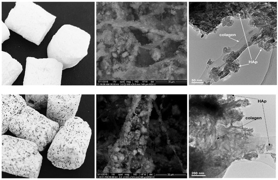 Current Options and Future Perspectives on Bone Graft and Biomaterials ...