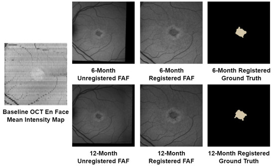 Applied Sciences | Free Full-Text | Using Ensemble OCT-Derived Features ...