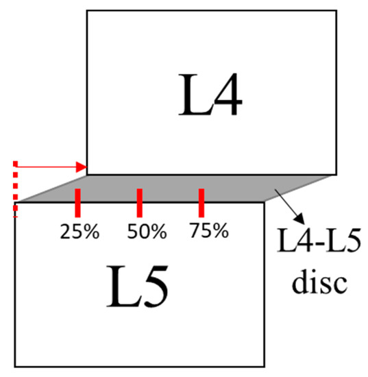 BUU-LSPINE: A Thai Open Lumbar Spine Dataset for Spondylolisthesis ...
