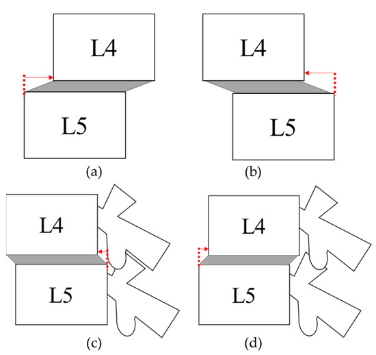 BUU-LSPINE: A Thai Open Lumbar Spine Dataset for Spondylolisthesis ...