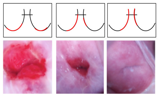 An Investigation of Transfer Learning Approaches to Overcome Limited ...