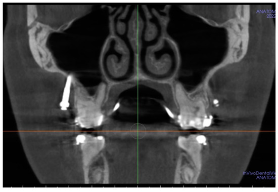 Applied Sciences | Free Full-Text | Quantitative Evaluation of the ...