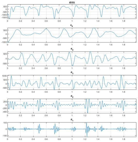 Implementation of Machine Learning and Deep Learning Techniques for the Detection of Epileptic ...