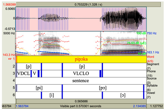 Interaction of Voice Onset Time with Vocal Hyperfunction and Voice Quality