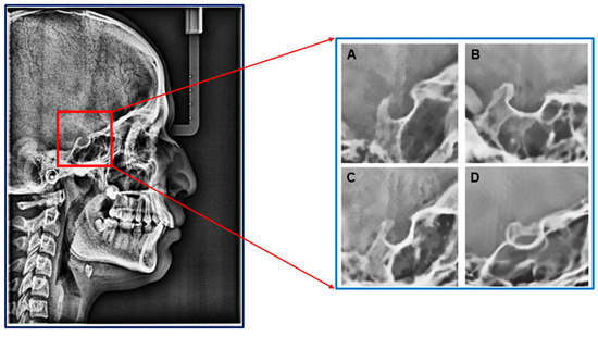 SellaMorph-Net: A Novel Machine Learning Approach for Precise ...
