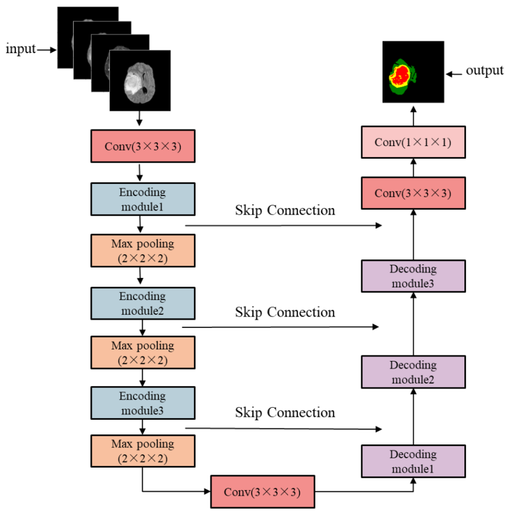 Applied Sciences | Free Full-Text | A Multi Brain Tumor Region ...