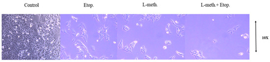 Cytotoxic Effect of L-Methioninase from Brevibacterium linens BL2 in ...