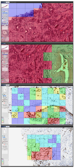 Deep Learning within a DICOM WSI Viewer for Histopathology