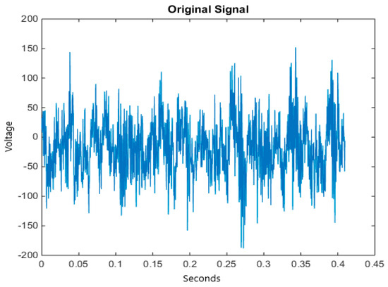 An Epileptic Seizure Detection Technique Using EEG Signals with Mobile Application Development