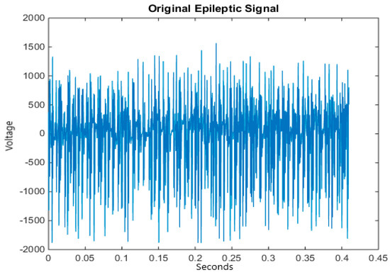 An Epileptic Seizure Detection Technique Using EEG Signals with Mobile Application Development