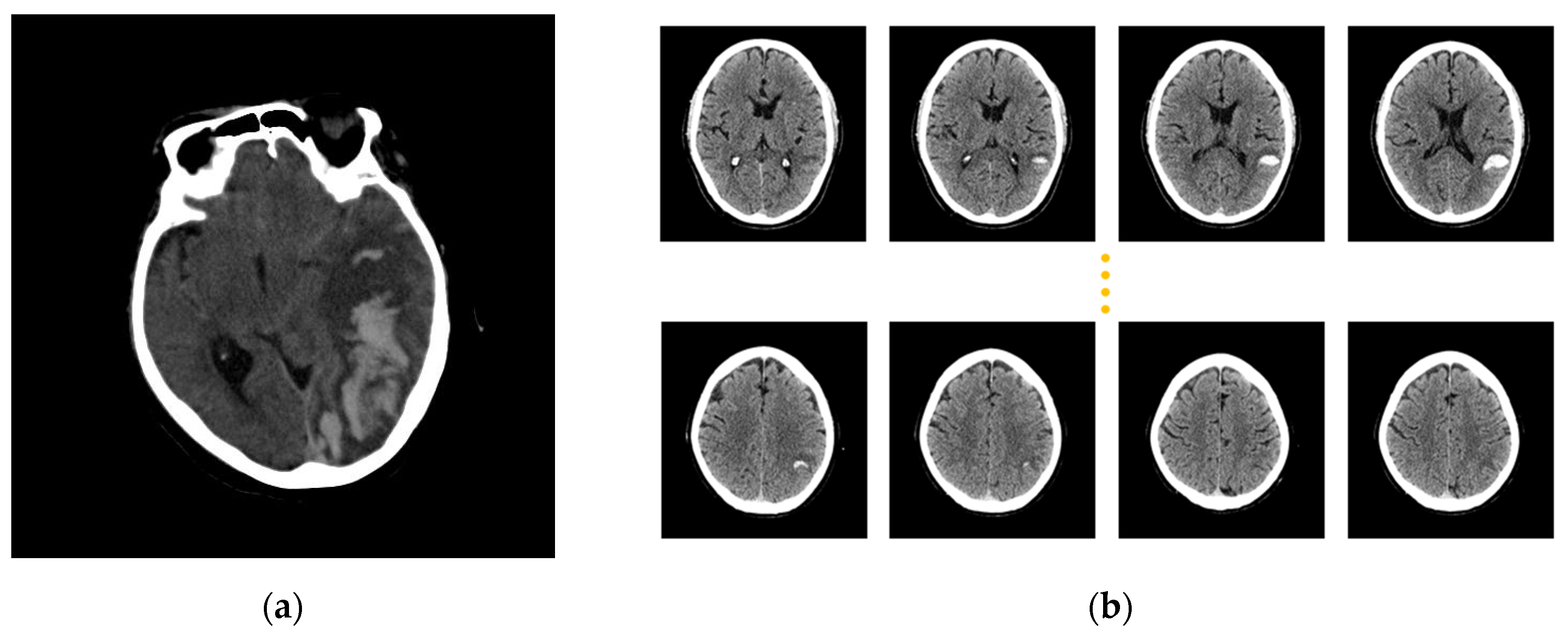 Convolutional Neural Network and Language Model-Based Sequential CT ...