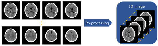 Convolutional Neural Network and Language Model-Based Sequential CT ...