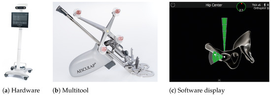 Robotic Systems and Navigation Techniques in Orthopedics: A Historical ...