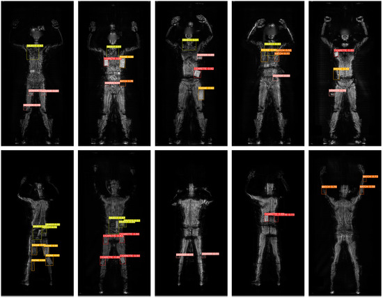Swin-YOLO for Concealed Object Detection in Millimeter Wave Images