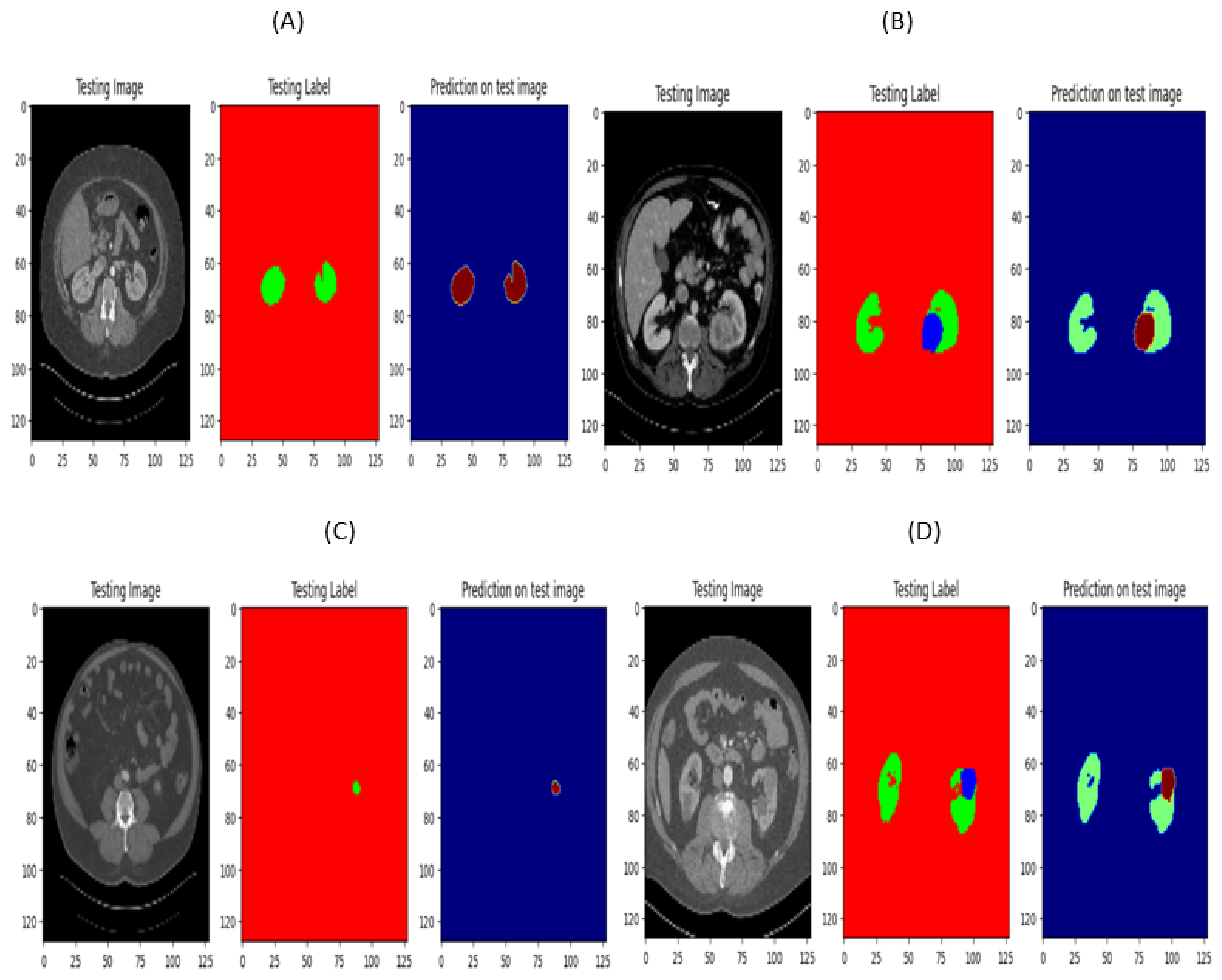 Applied Sciences | Free Full-Text | FPN-SE-ResNet Model for Accurate ...