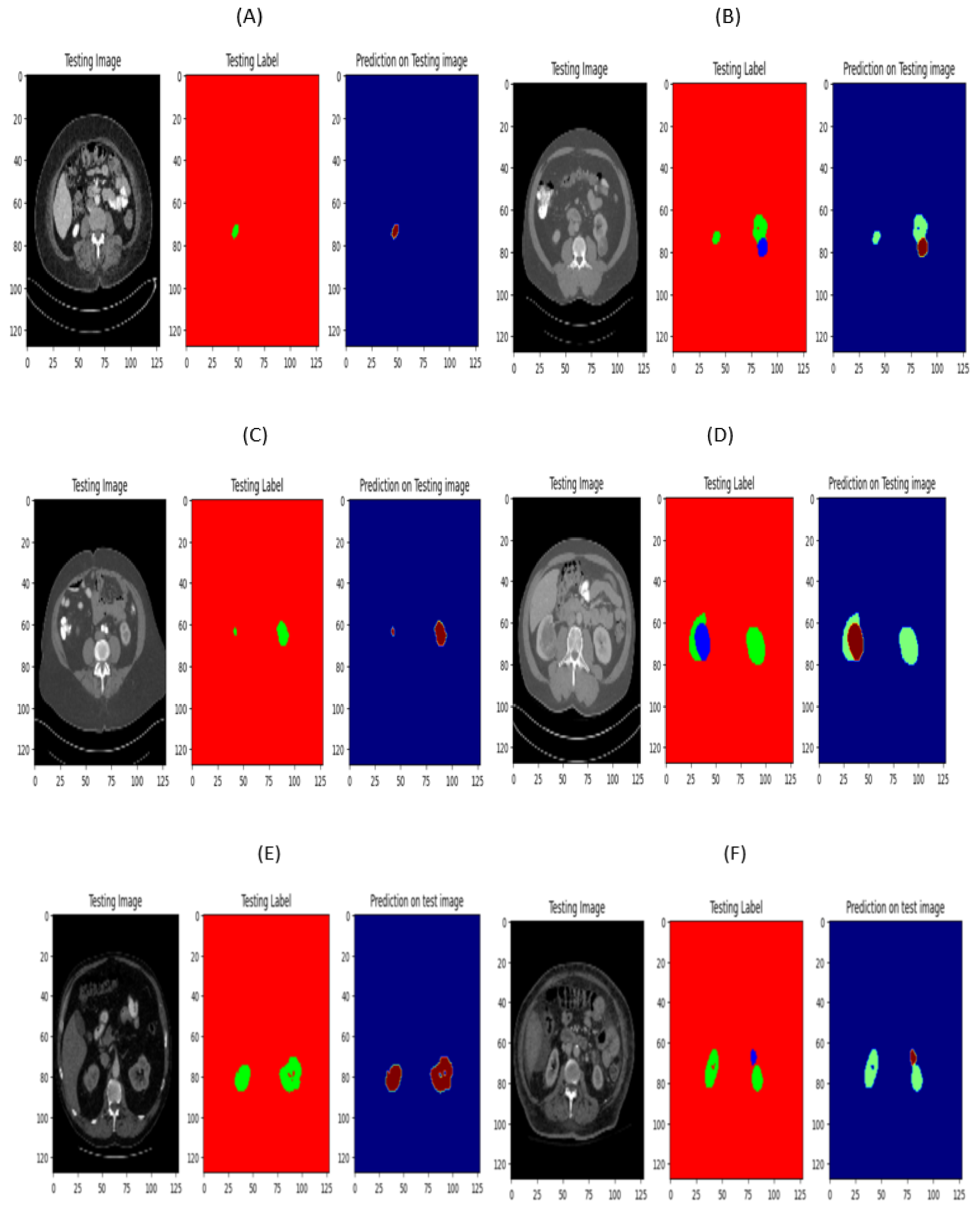 Applied Sciences | Free Full-Text | FPN-SE-ResNet Model for Accurate ...