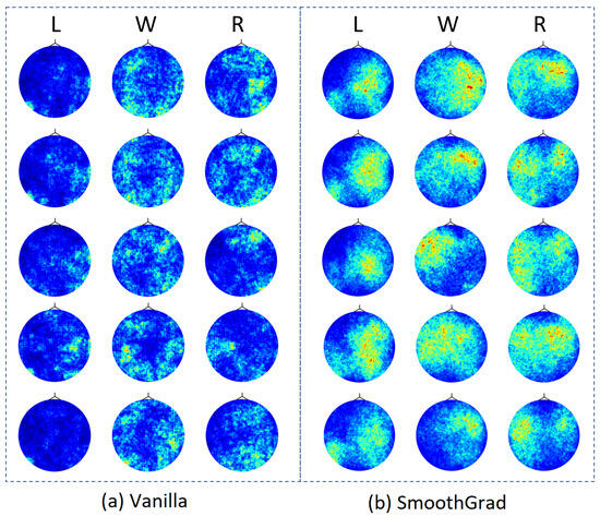 Deep Representation Of Eeg Signals Using Spatio Spectral Feature Images