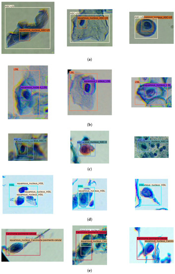 Improving Mobile-Based Cervical Cytology Screening: A Deep Learning ...